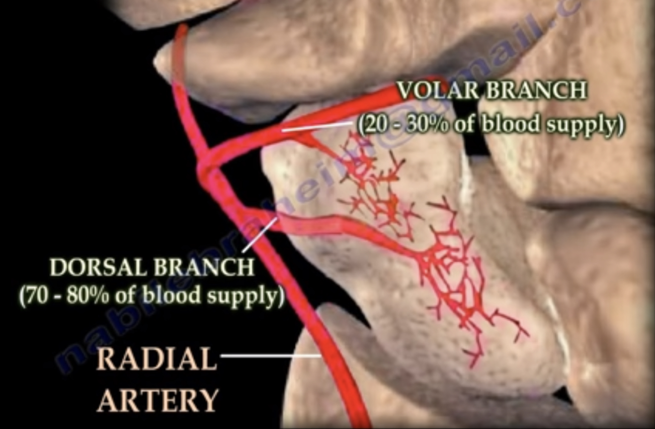 Scaphoid Fracture – Fife Virtual Hand Clinic