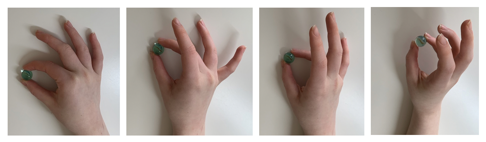 Recovering from a Wrist Fracture – Fife Virtual Hand Clinic
