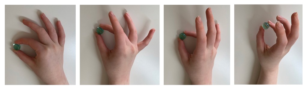 Recovering from a Wrist Fracture – Fife Virtual Hand Clinic