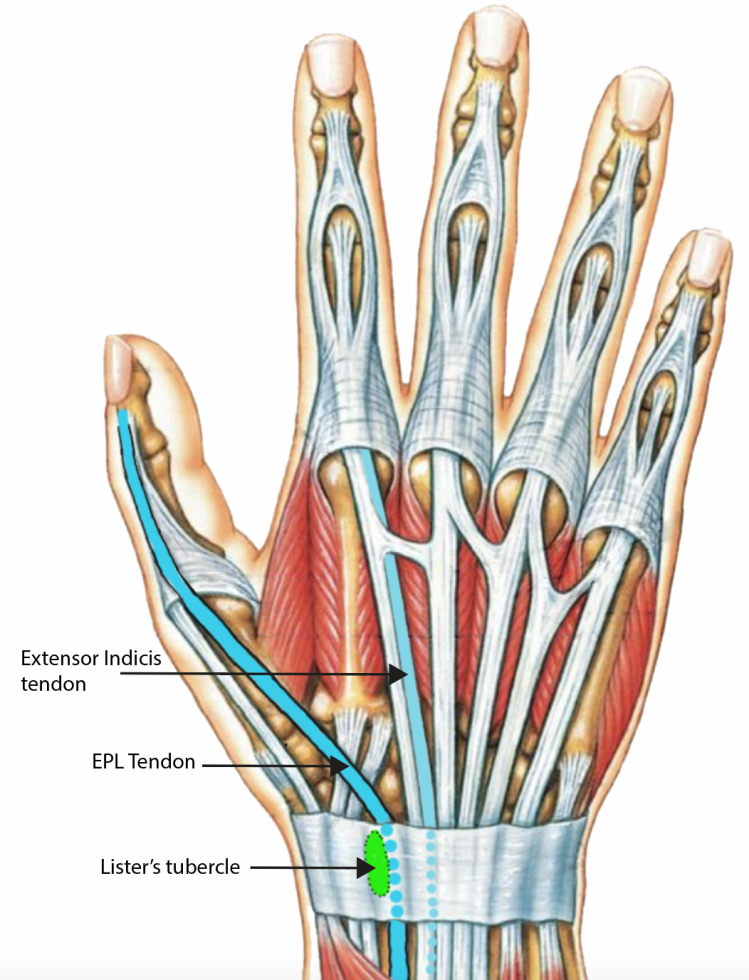 Rupture of the Extensor Pollicis Longus (EPL) tendon – Fife Virtual ...