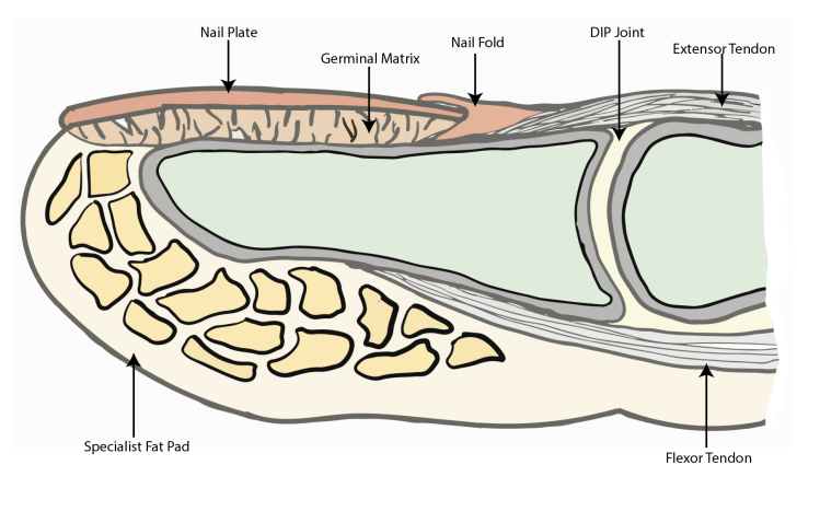Fingertip Injuries – Fife Virtual Hand Clinic