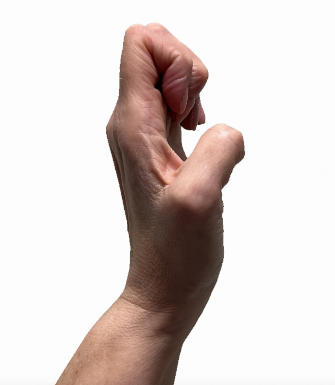 Trigger Finger Nonoperative Management – Fife Virtual Hand Clinic